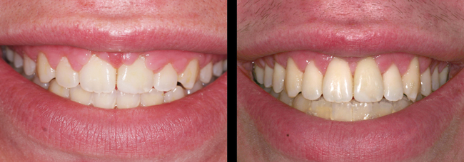 Treatment Gallery - Sterrett Periodontics